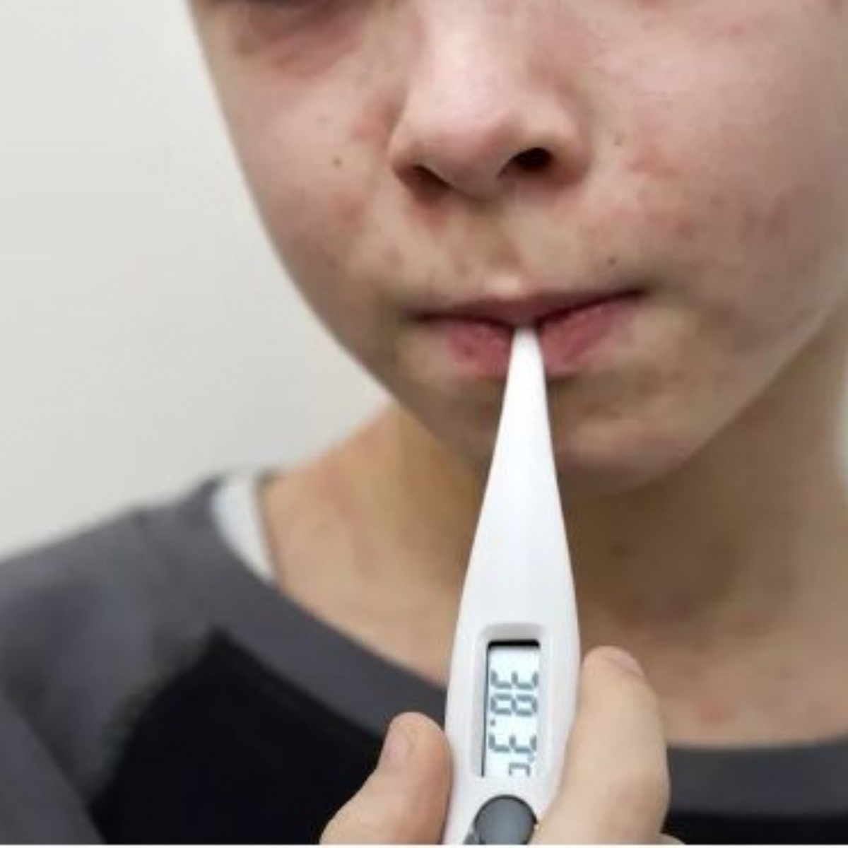 Dorchester Primary - Get measles vaccine to avoid rapid spread, says UK ...
